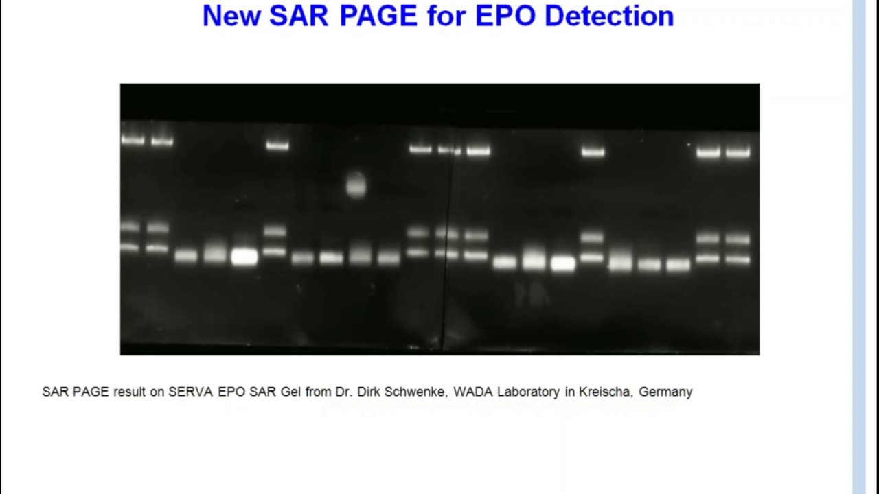 SERVA Webinar: Sarcosyl – an Alternative Anionic Detergent for PAGE ...