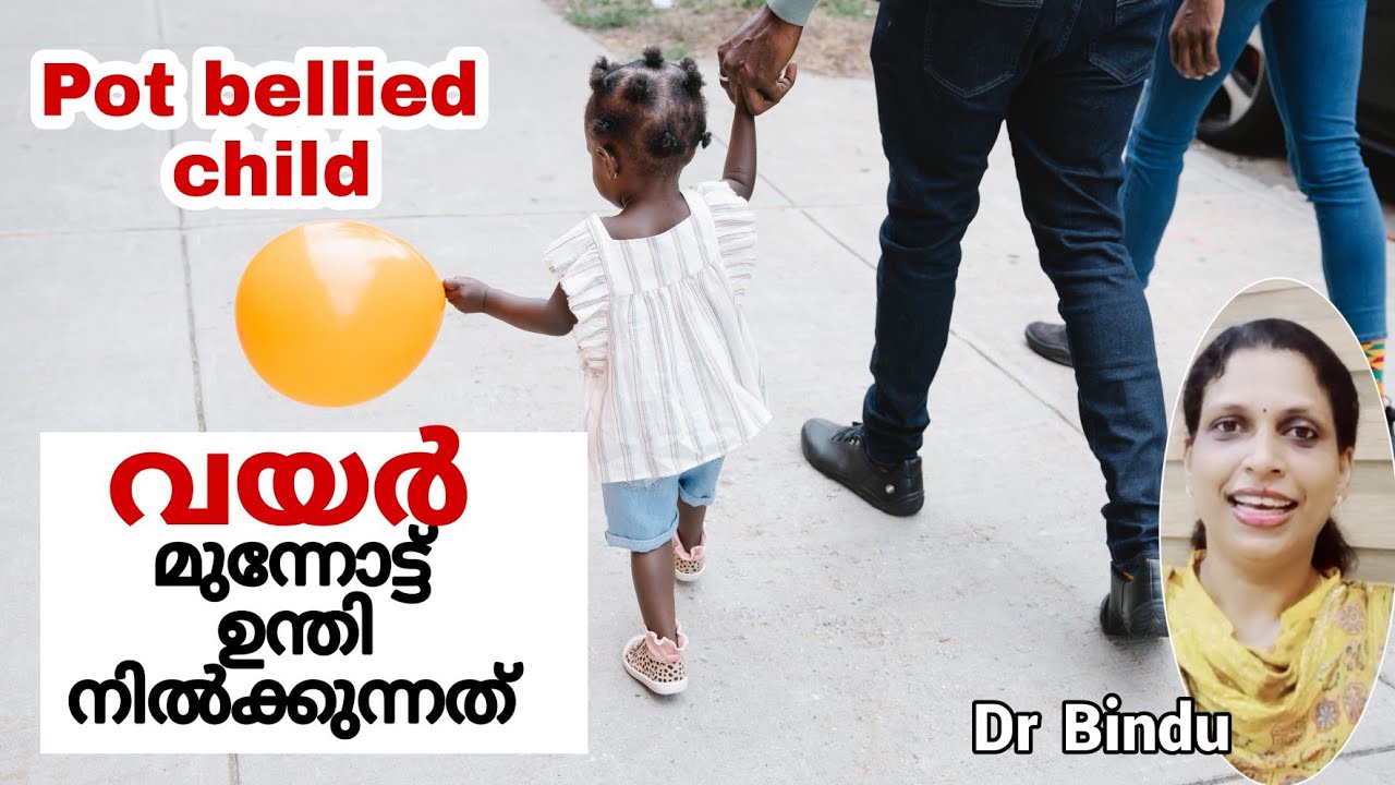 കുഞ്ഞുങ്ങളുടെ വയർ മുന്നോട്ട് ഉന്തി നിൽക്കുന്നത് പേടിക്കണോ ?/Pot bellied ...