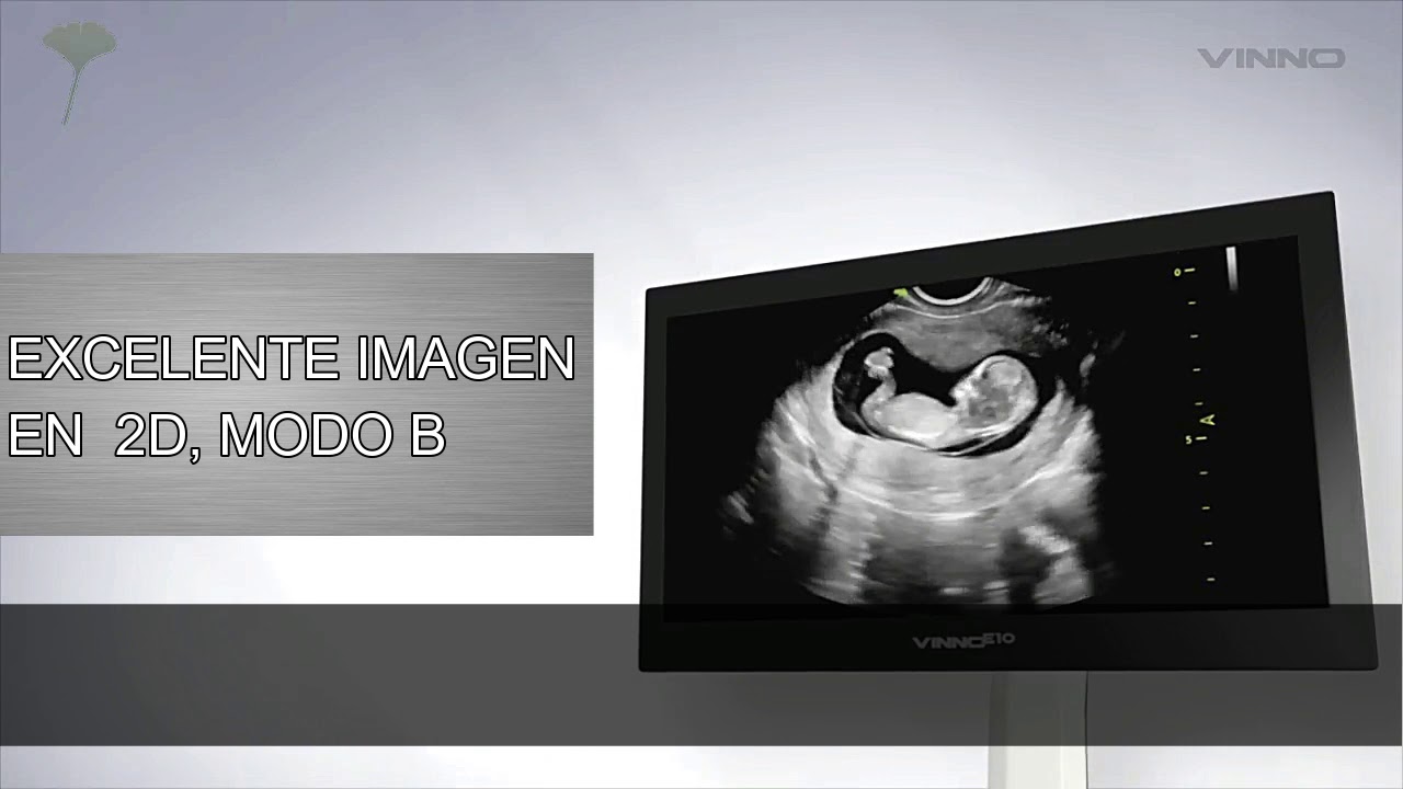 VINNO X2 5D HD - YouTube