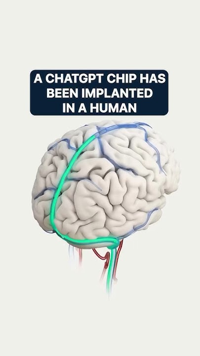 A ChatGPT chip has been implanted in a human | New Technology | Pro ...
