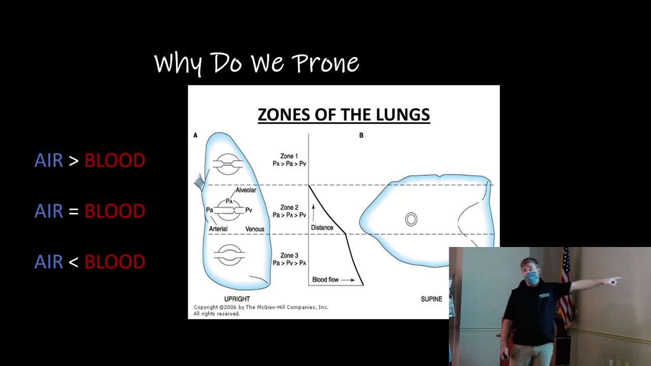 Vent Management Strategies and Overview - YouTube