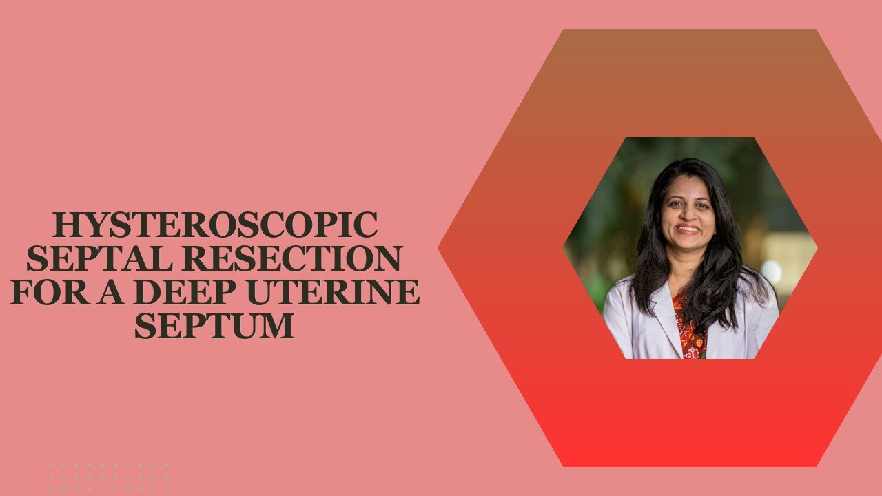 Septal Resection in a case of Recurrent Abortions | Dr Shilpa G B - YouTube