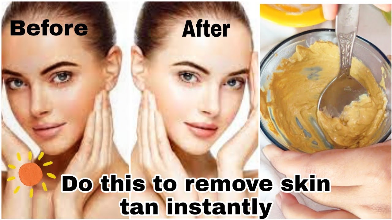 I did this to remove skin tan and was shocked by the result | Skin tan ...