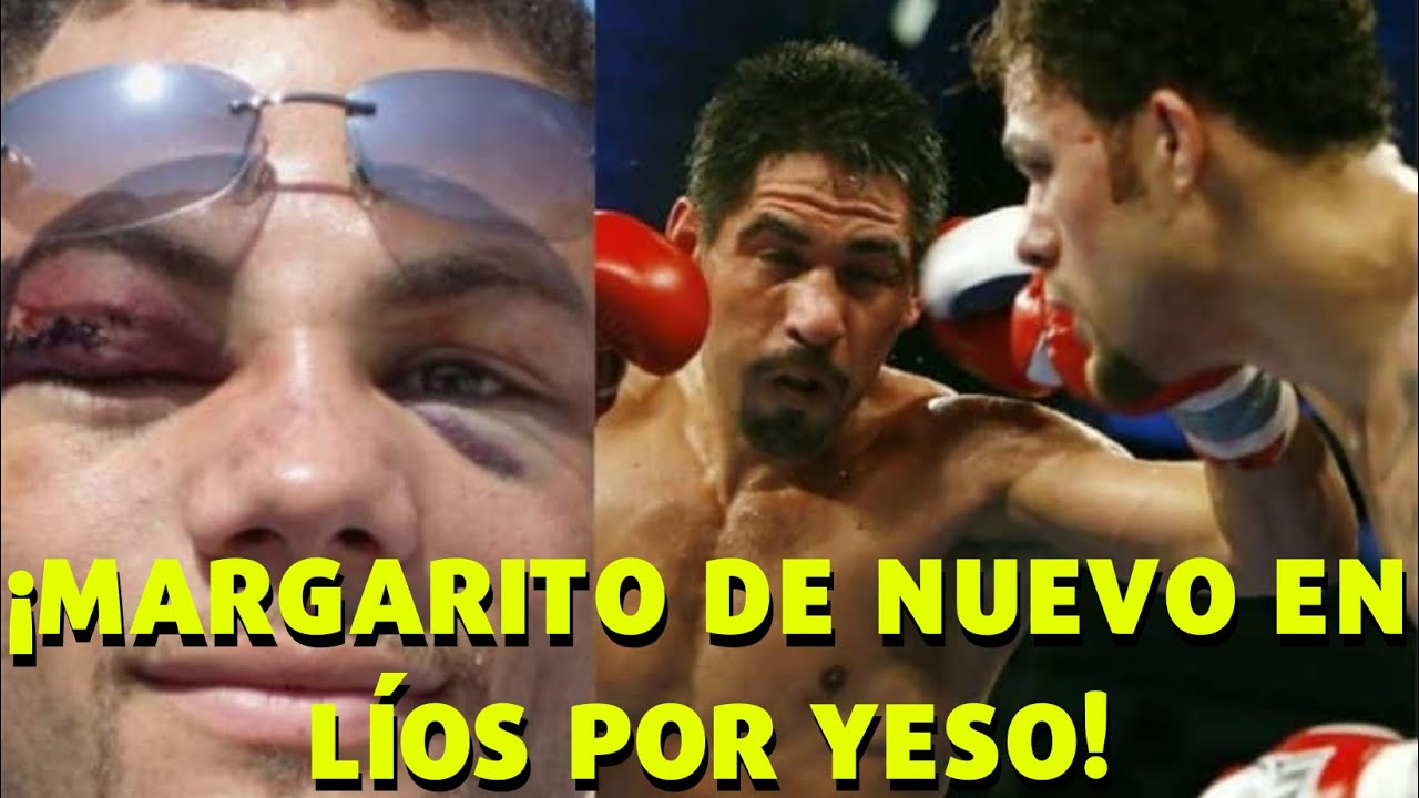 ANTONIO MARGARITO UNA VEZ MÁS EXPUESTO POR EL YESO EN SUS VENDAJES ...