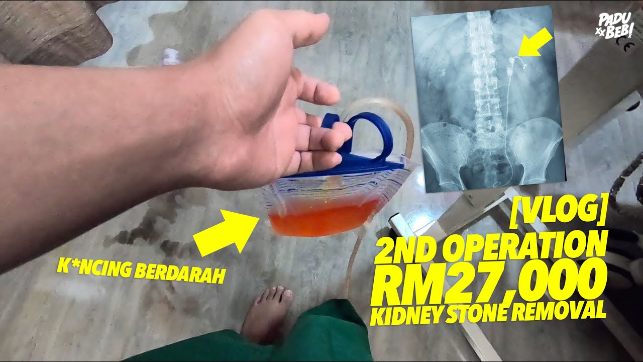 Operation Ke-2 Buang Batu Karang, Telan Belanja RM27,000! - YouTube
