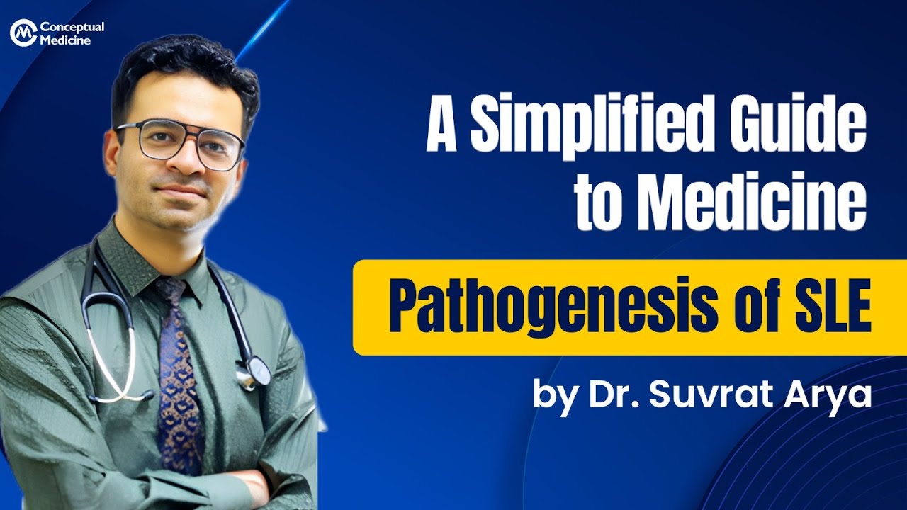 A Simplified Guide to Medicine: Pathogenesis of SLE by Dr. Suvrat Arya ...