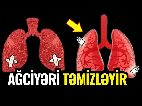 Ağciyəri 3 günə Təmizləyən 4 Möcüzəvi bitkilər