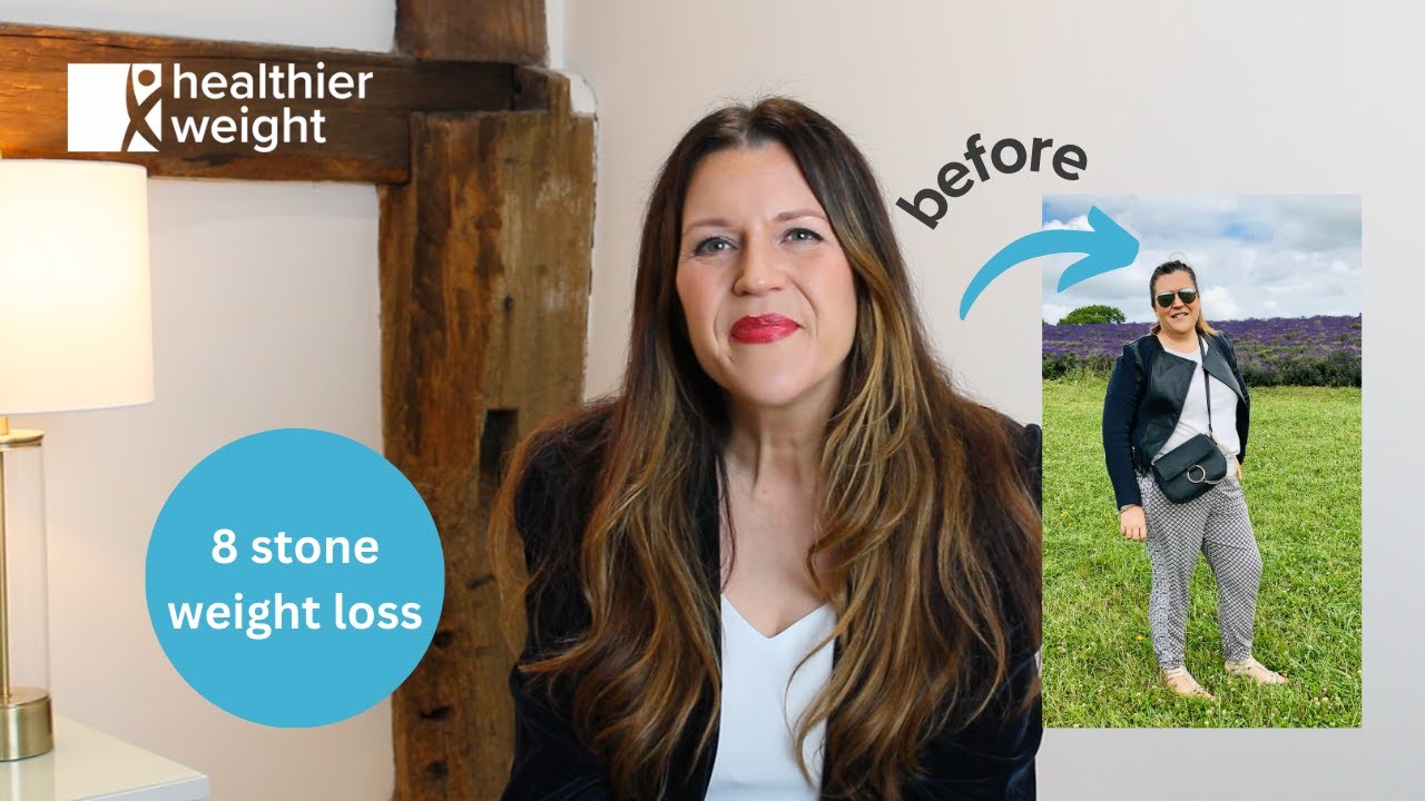 Maries's story with a gastric sleeve - 8 stone weight loss - YouTube