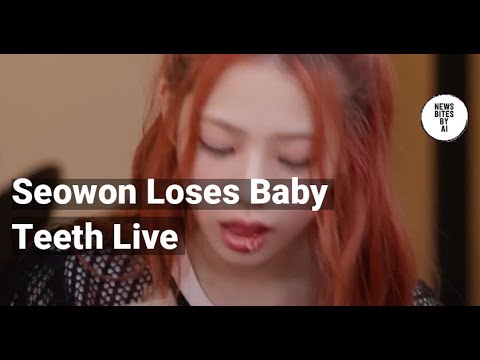 UNI's Seowon Shockingly Loses Baby Teeth Live on Broadcast - YouTube