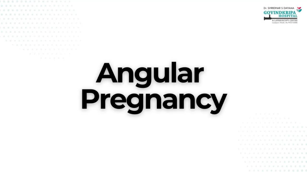 Angular Pregnancy as seen On Hysteroscopy - YouTube