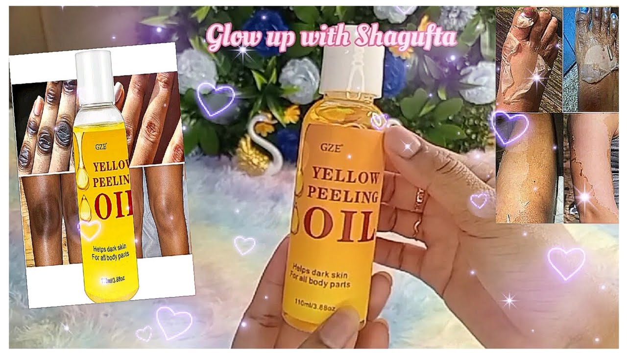 Yellow Peeling Oil Review | Before and after skin peeling ...