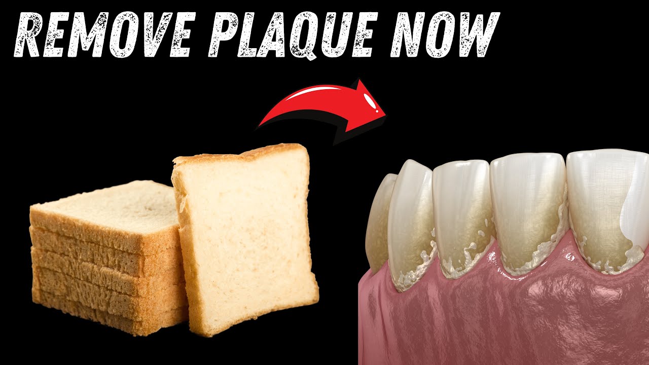 NATURAL WAYS TO REMOVE PLAQUE ASAP ! - YouTube