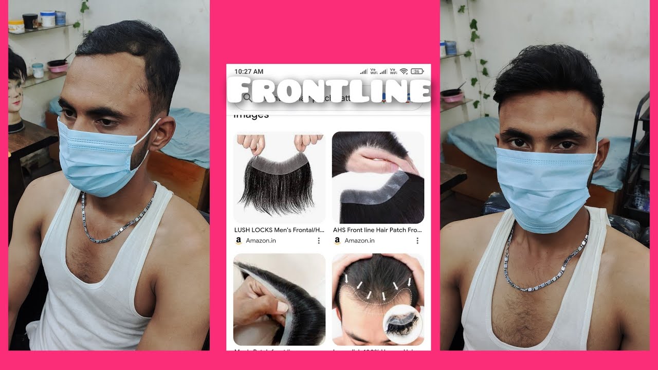 frontline hair patch laxminagar metro station gate1 Delhi,9654640224 ...