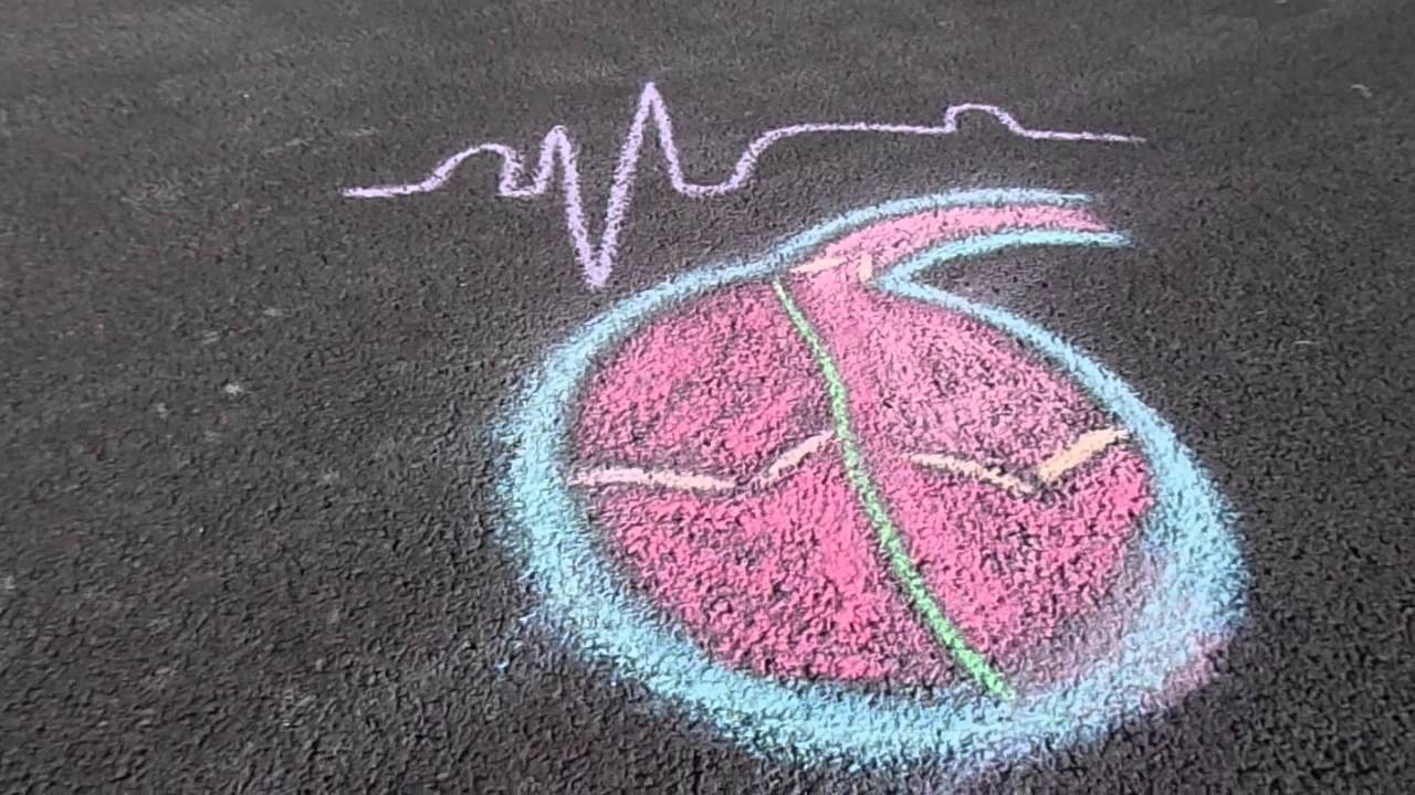Pathophysiology Valvular Heart Disease YouTube pathophysiology-valvular-heart-disease-youtube
