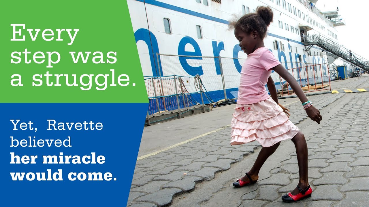 People With Backwards Legs