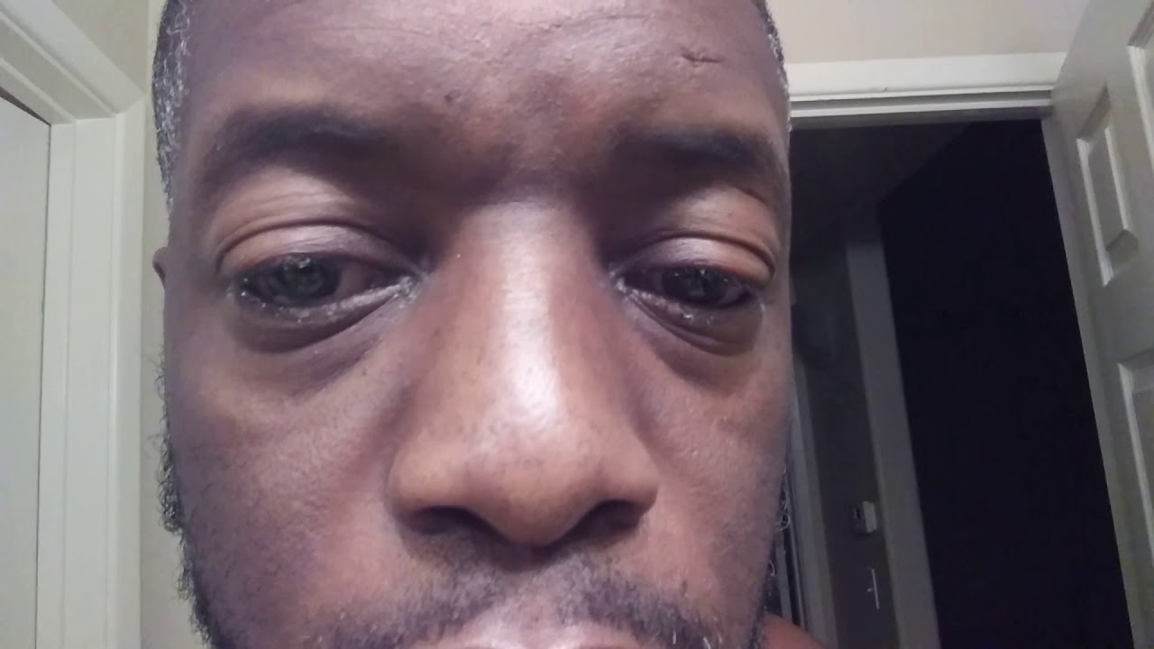 Dr sebi eyewash "shocking results" - YouTube