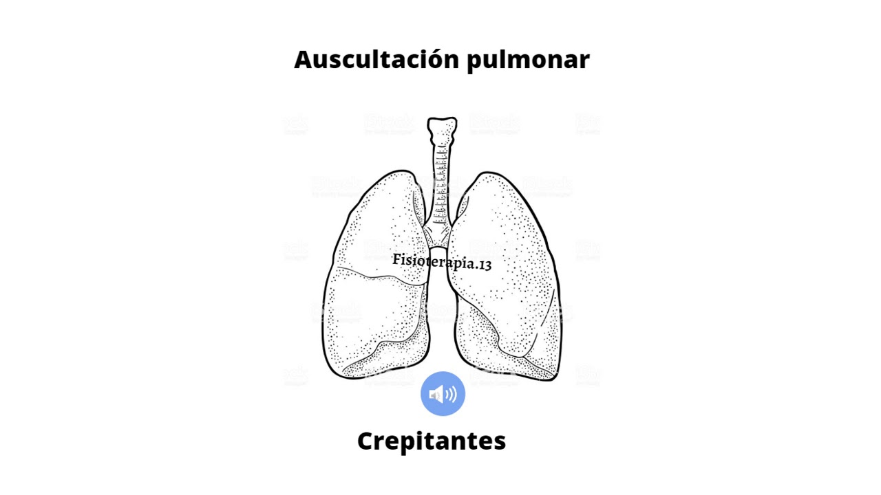 Ruidos respiratorios agregados - Crespitantes - YouTube