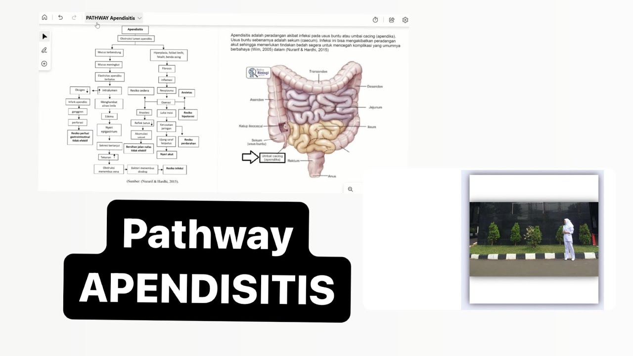 Pathway Appendicitis | DIAGNOSA KEPERAWATAN eps.27 - YouTube