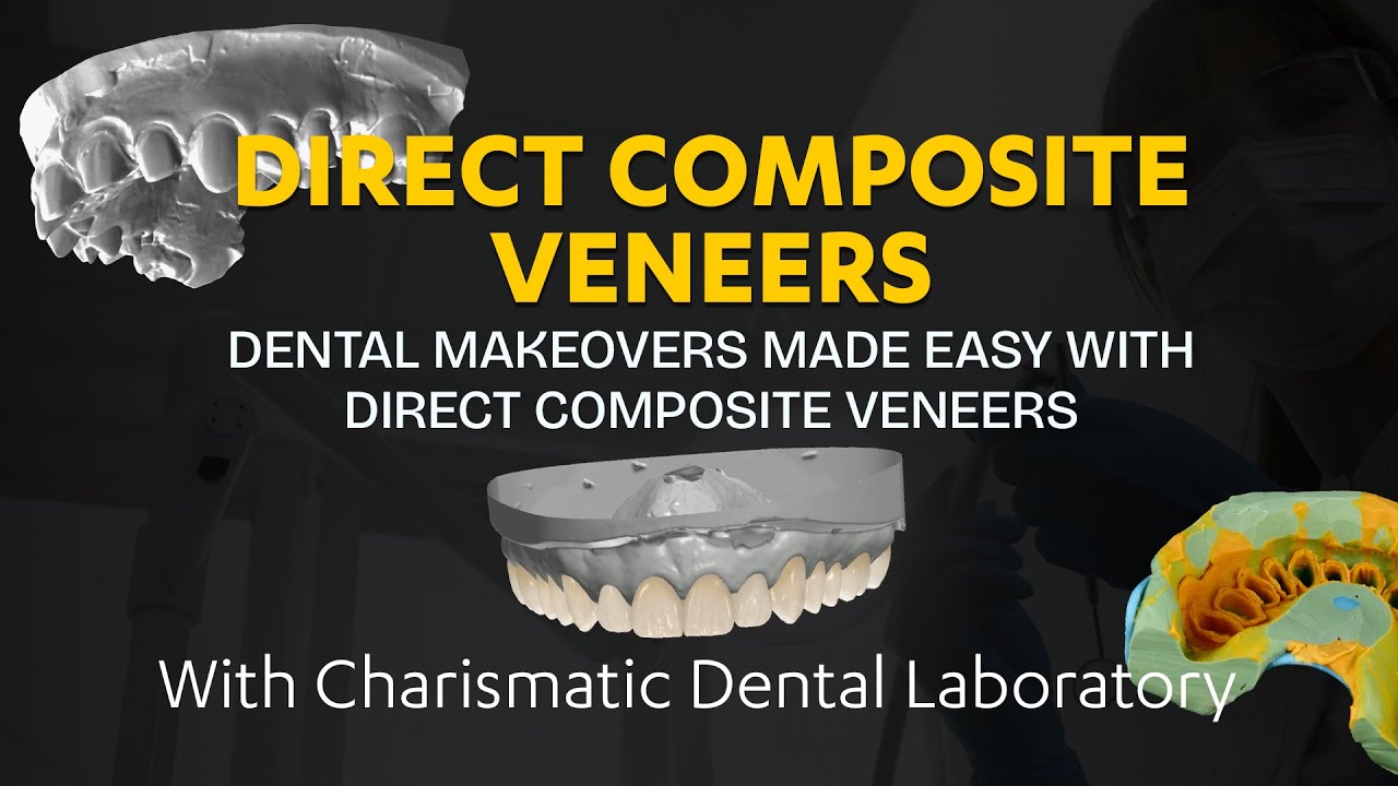 How to make Direct Composite Veneers with Charismatic Dental Laboratory ...