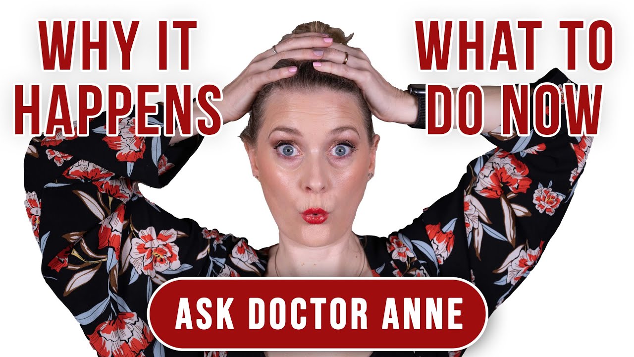 Preventing Hair Loss in men and women: Expert Advice | Ask Doctor Anne ...