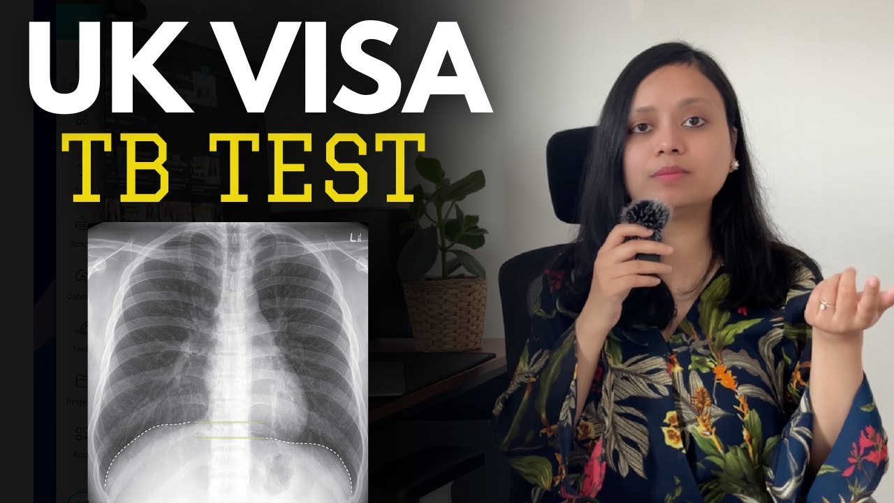 TB Test For UK Visa Complete Process - YouTube