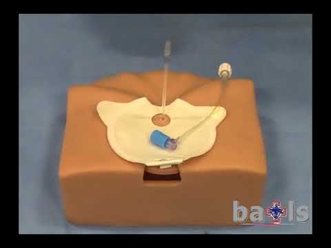 Intraosseous Access FAST IO - YouTube