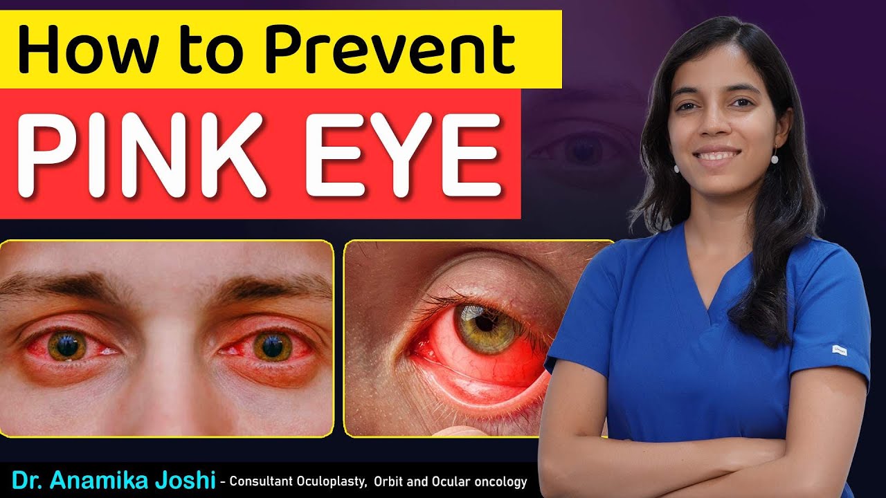 How to prevent pink eye | How to prevent conjunctivitis eye | Dr ...