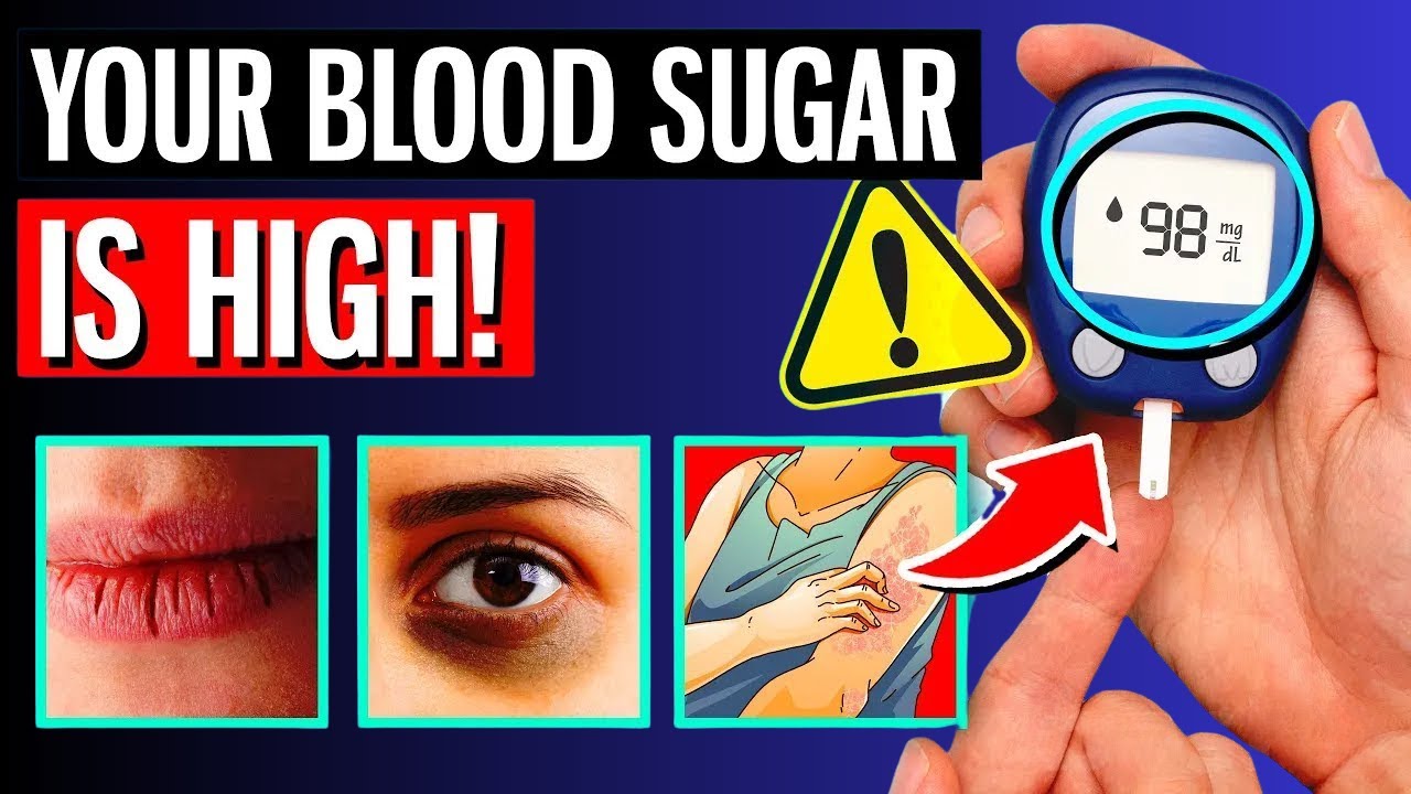 10 WARNING Signs Your Blood Sugar Is High - YouTube