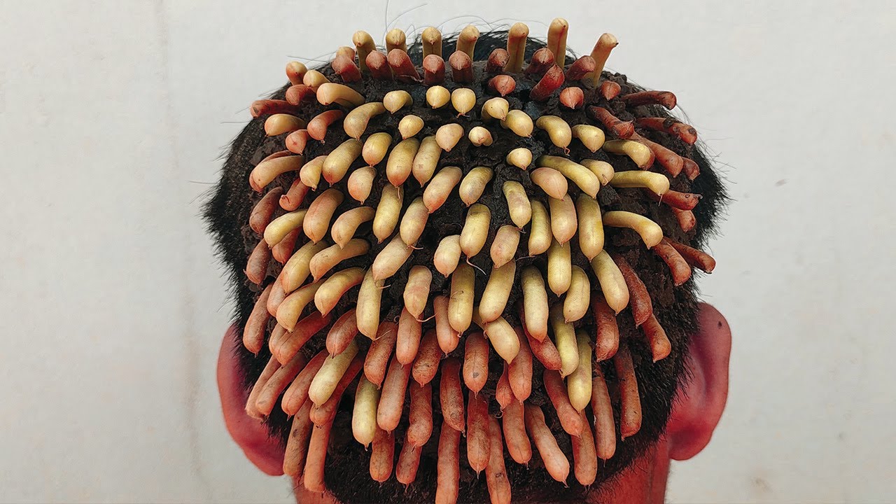 OMG!! Secret Worms With Dandruff Cleaning #24 - YouTube