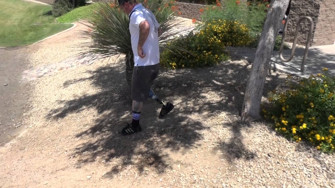 Matt Hawkins prosthetic RUSH Foot™ test - YouTube