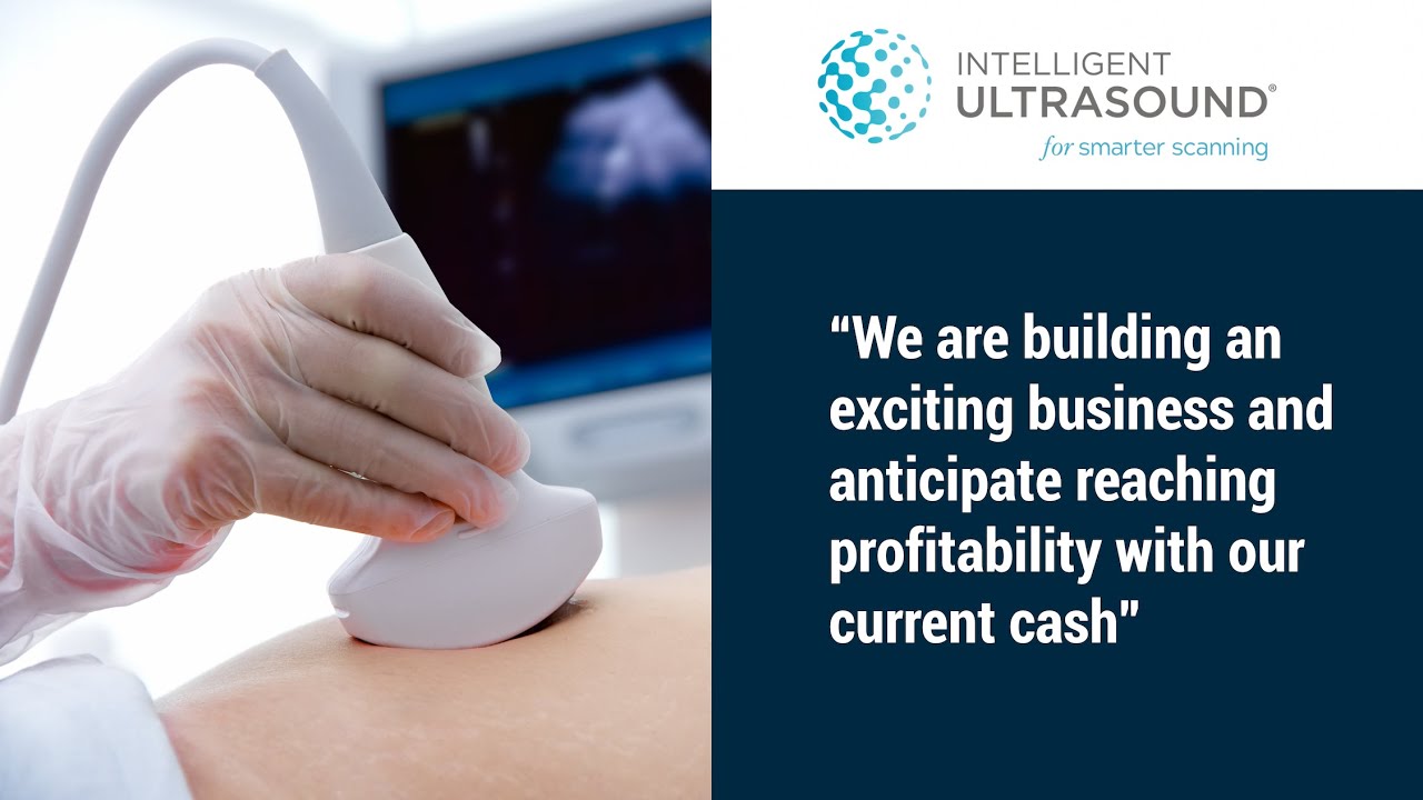 Q&A with Intelligent Ultrasound CEO, Stuart Gall - YouTube