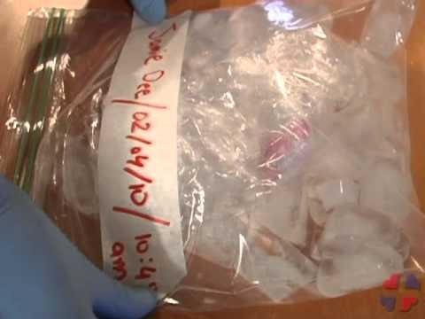 Amputations with Nick Rondinelli | Heart2Heart First Aid Training ...