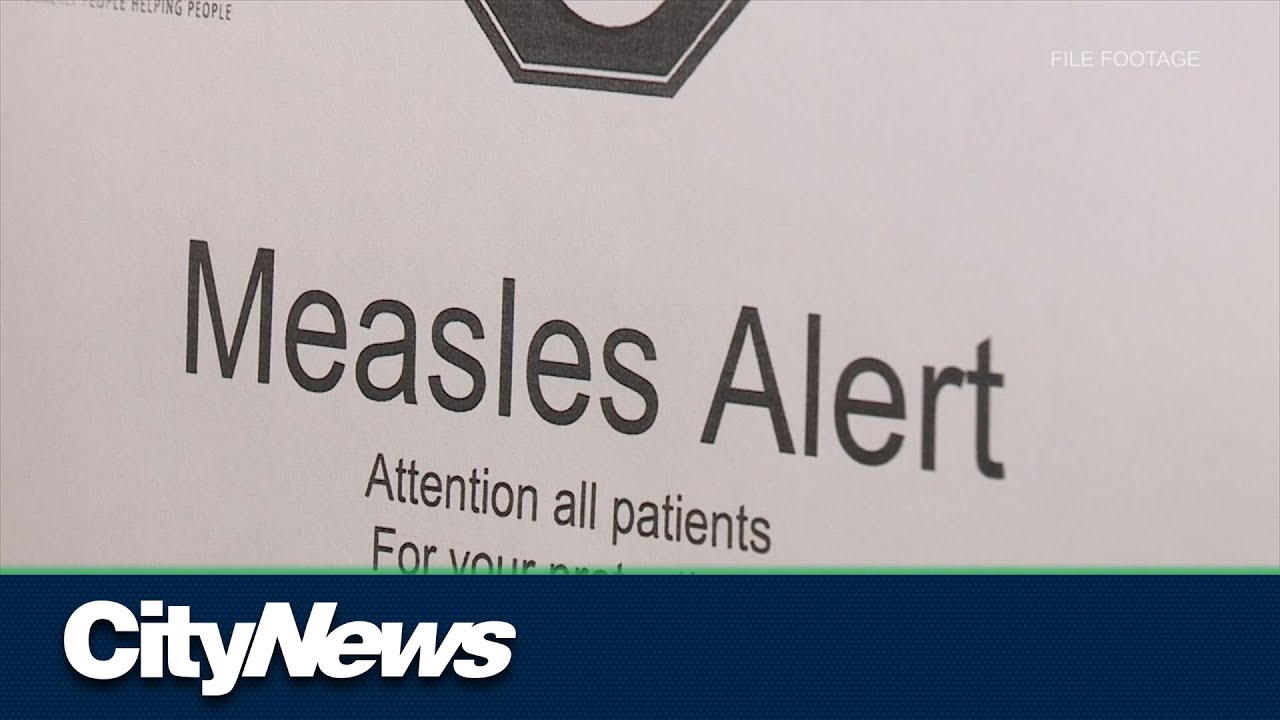 'Unique' Ontario measles case under investigation - YouTube