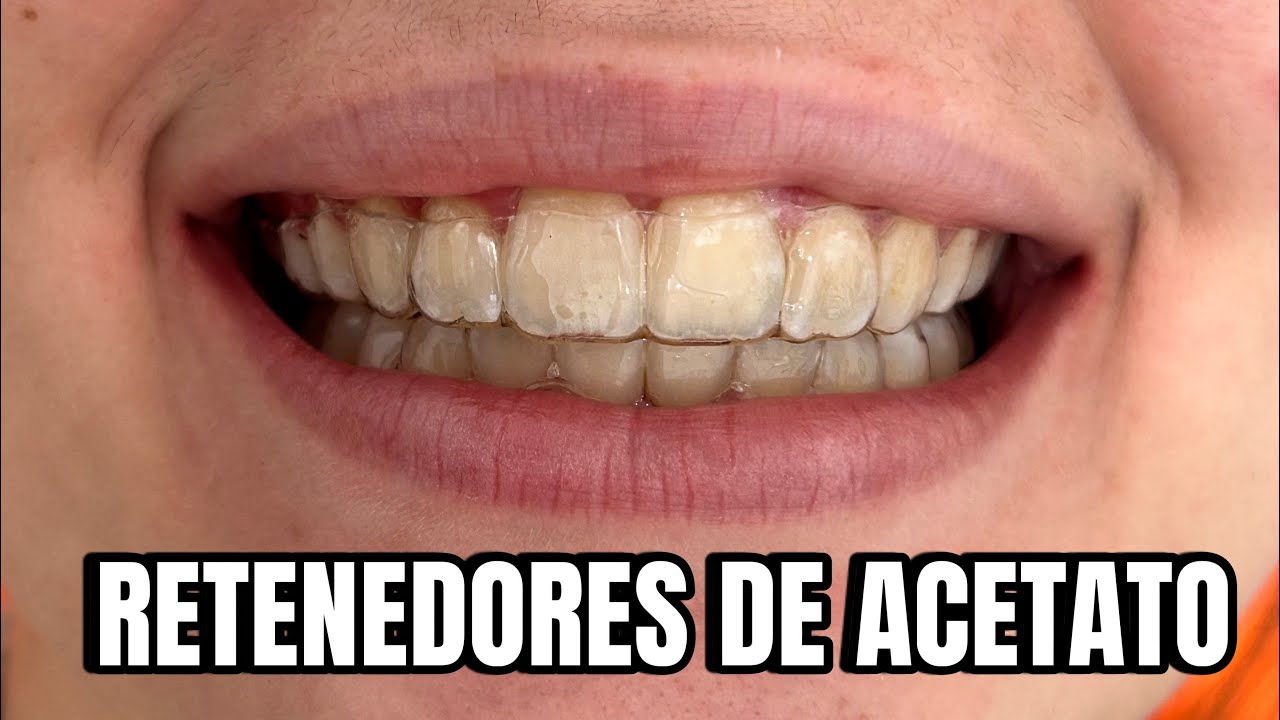 RETENEDORES DE ACETATO POST ORTODONCIA 😁 - YouTube