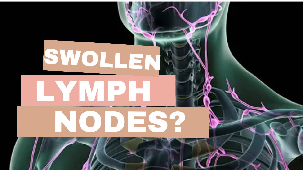 Swollen Lymph Nodes: Chest and Axillary - YouTube