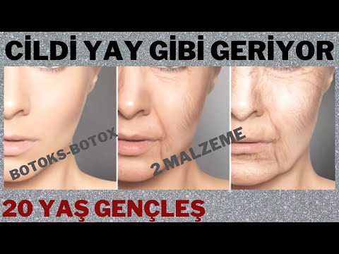 Muz Kabuğu Göz Altlarına Böyle Yerleştir, Göz Altı Işık Dolgusu, Yüz İçin Evde Botoks Maskesi.
