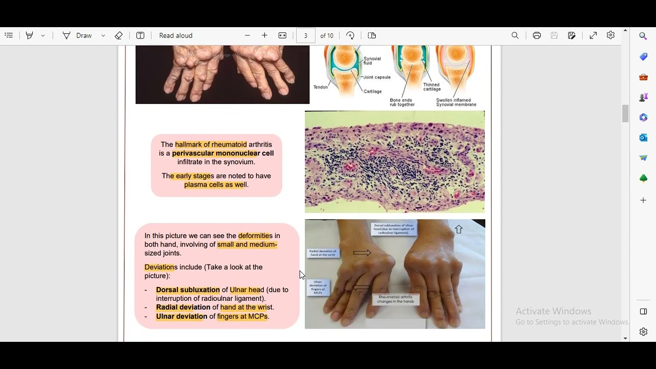 OLA MSS Medicine 2 (Rheumatology) - YouTube