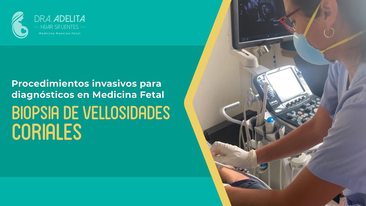 Biopsia de vellosidades coriales - YouTube