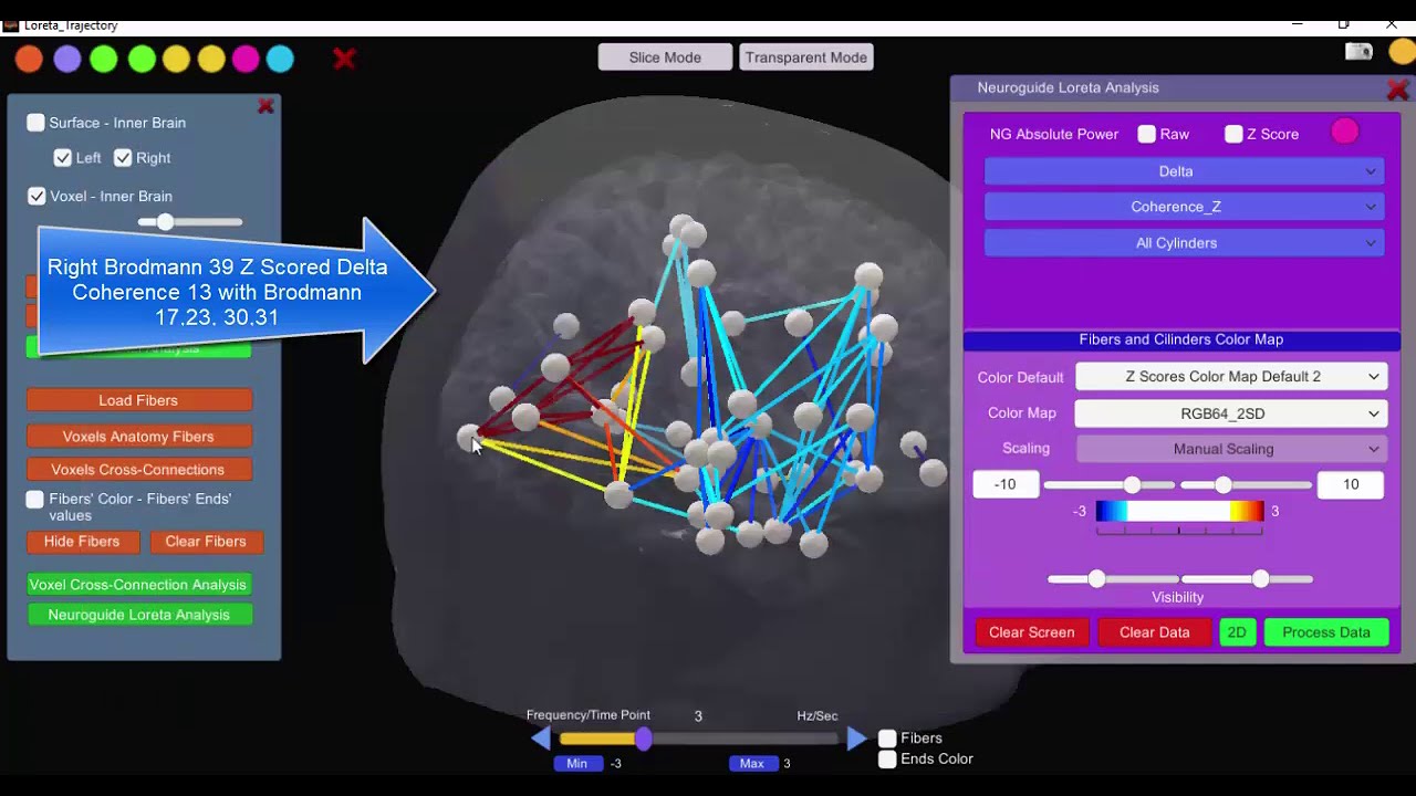 Neuroguide : Coherence, PhaseDiff, PhaseLock, PhaseShift ...