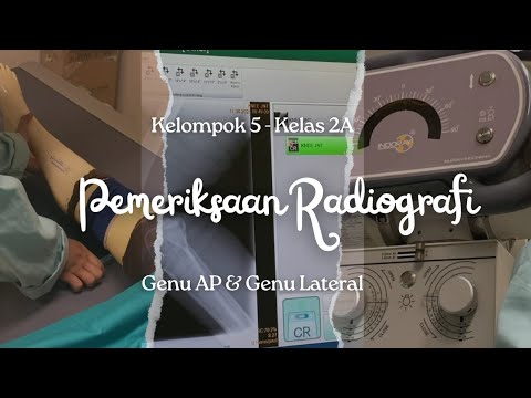 Pemeriksaan Radiografi Genu AP dan Genu Lateral Kelompok 5 Kelas 2A ...