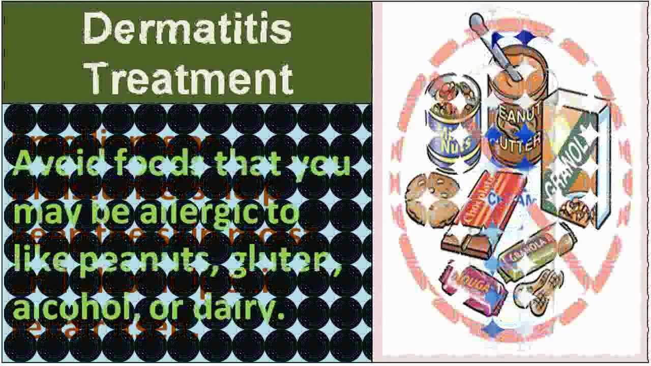 See treatment contact dermatitis- Watch Now! - YouTube