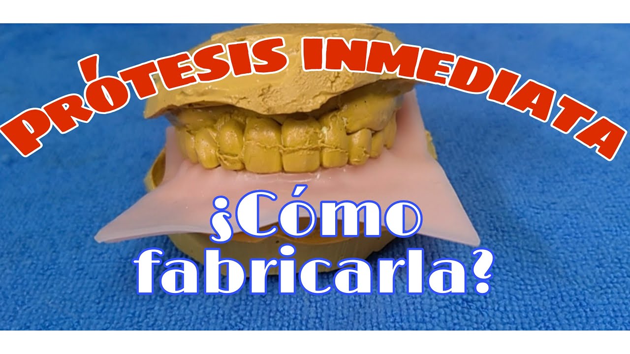 Prótesis Dental total inmediata - YouTube