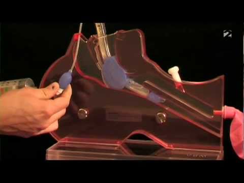 Larynxtubus (LT, LTS, LTS-D) - YouTube