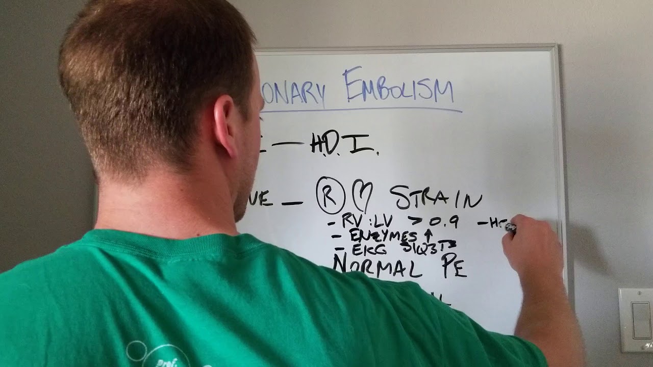 Pulmonary Embolism (PE)- Subtypes and Management - YouTube
