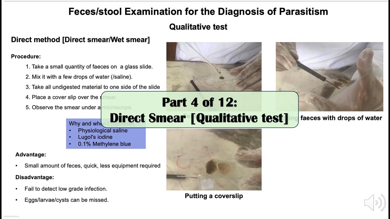 Part 4: Direct smear of faces or stool for the diagnosis of parasitism ...