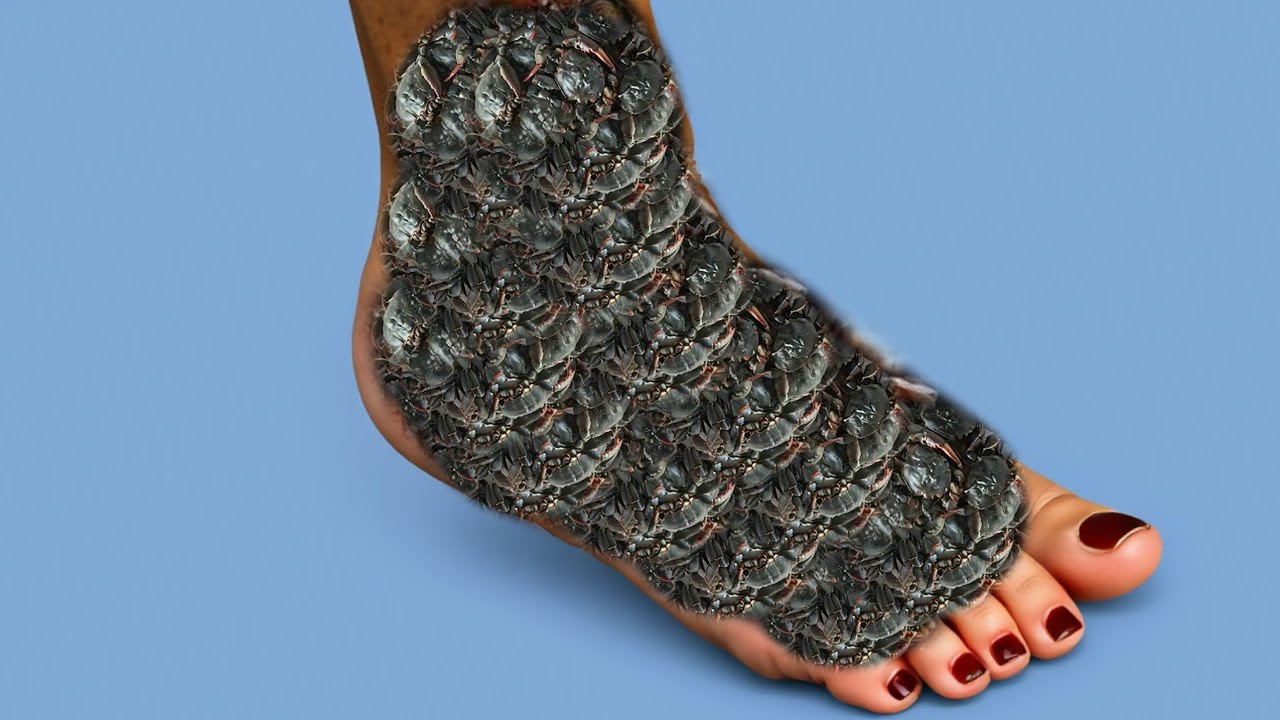 ASMR Animation Foot Treatment: Removing Ticks and Deep Cleaning from ...