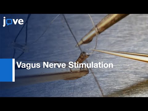 Vagus Nerve Stimulation: Induce Plasticity-Pathways Relevant ...