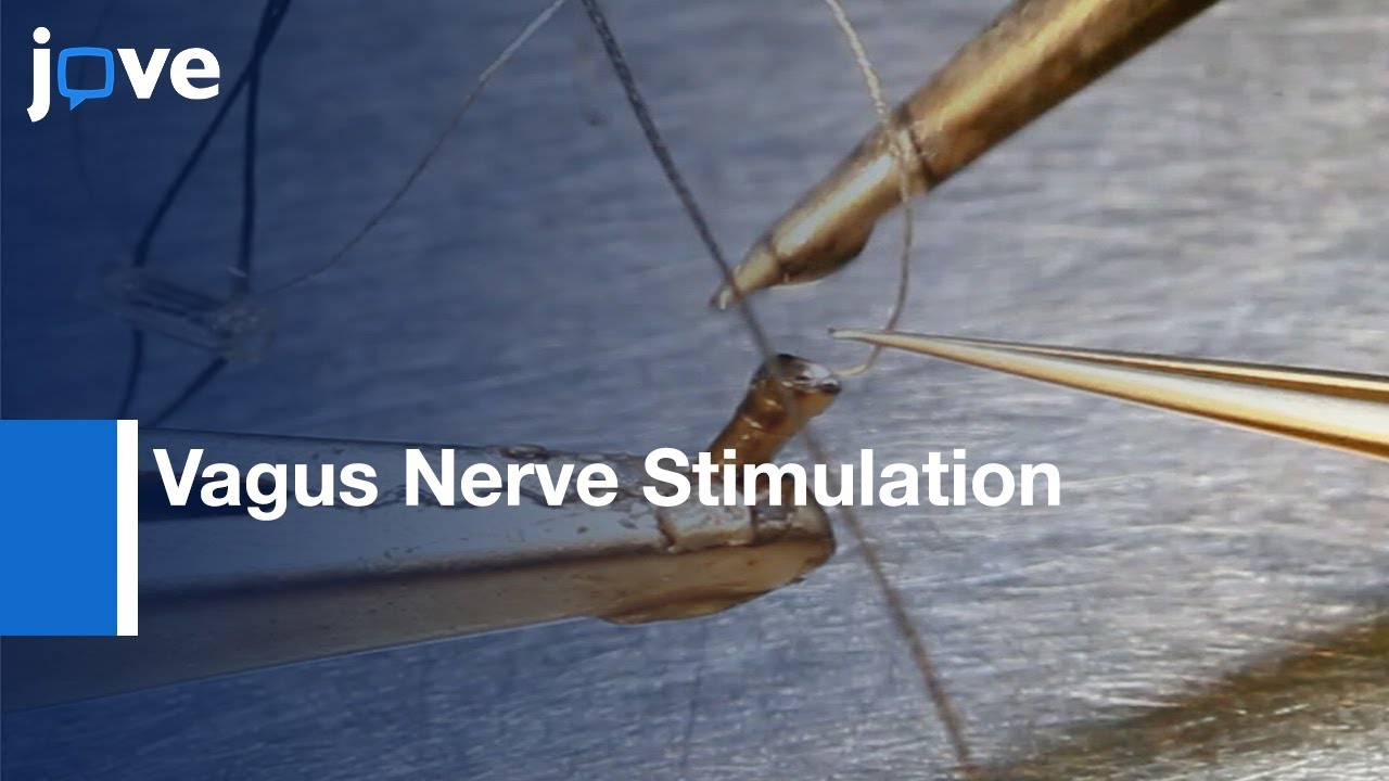 Vagus Nerve Stimulation: Induce Plasticity-Pathways Relevant ...