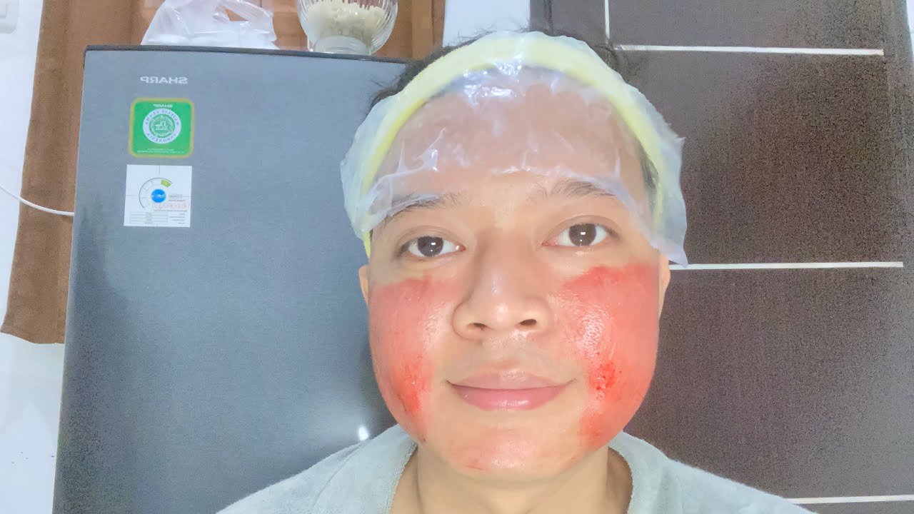Derma roller wajah ke 2x … - YouTube