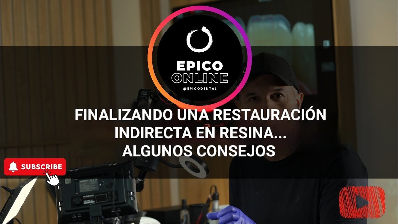 FINALIZANDO UNA RESTAURACIÓN INDIRECTA EN RESINA... Consejos prácticos ...